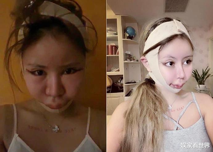 This 16-Year-Old Girl Undergoes 100 Cosmetic Procedures in 3 Years